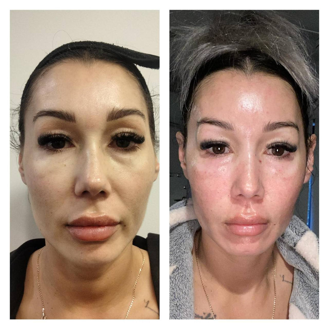 Miami Kiss Skin & Body Aesthetics – Miami Kiss Gold Coast